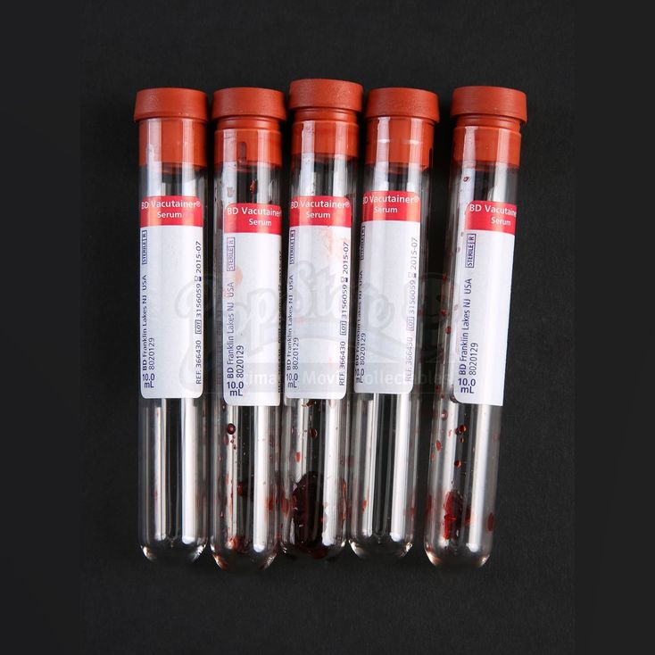 CSI Lab Blood Vials | HANNIBAL (2013-2015)