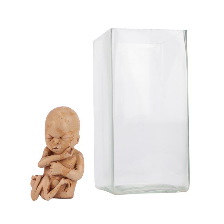 Lot # 1834: THE X-FILES - ESSENCE (2001) - Alien-Human Hybrid Foetus ...