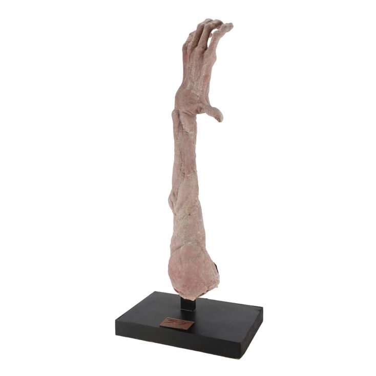 430. Ephialtes' (Andrew Tiernan) Arm ### 300 (2006)