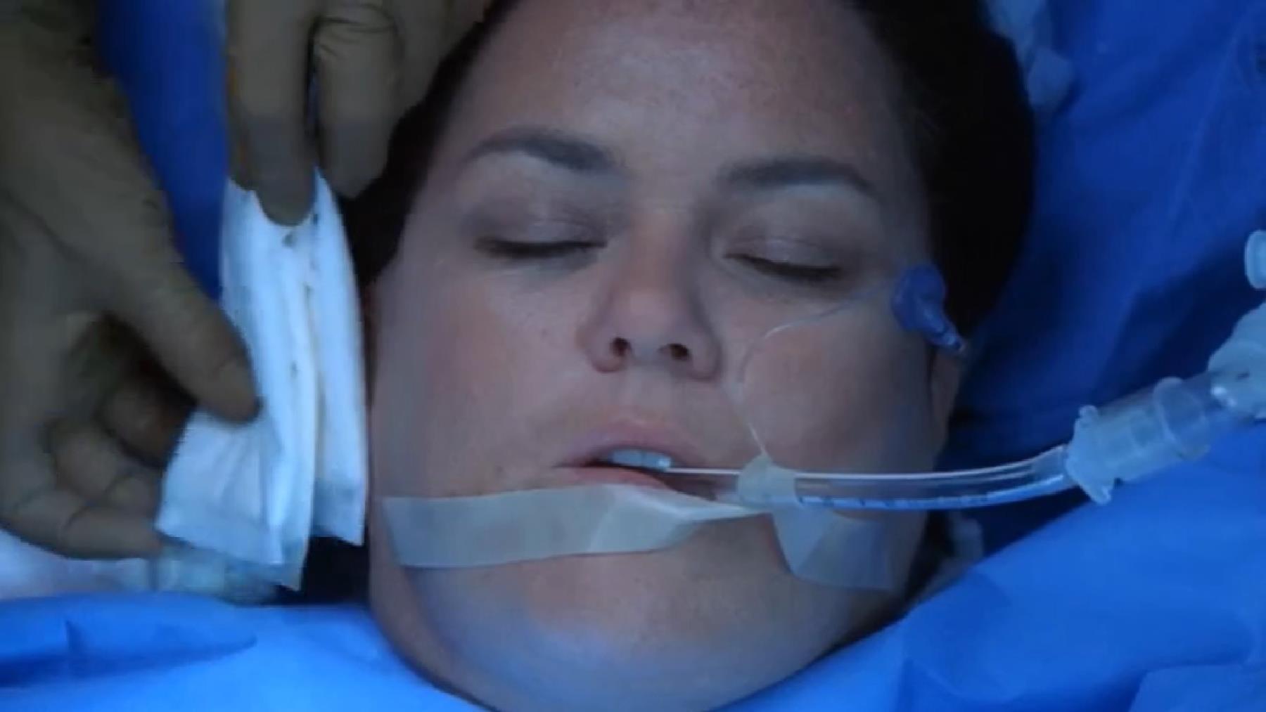 Dawn Budges (Rosie ODonnell) Special Effects Insert Bust | NIP/TUCK (T ...