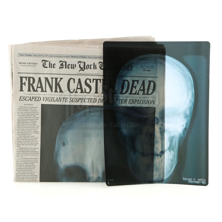 Frank Castle Head X-Ray and New York Examiner | MARVEL'S DAREDEVIL ...